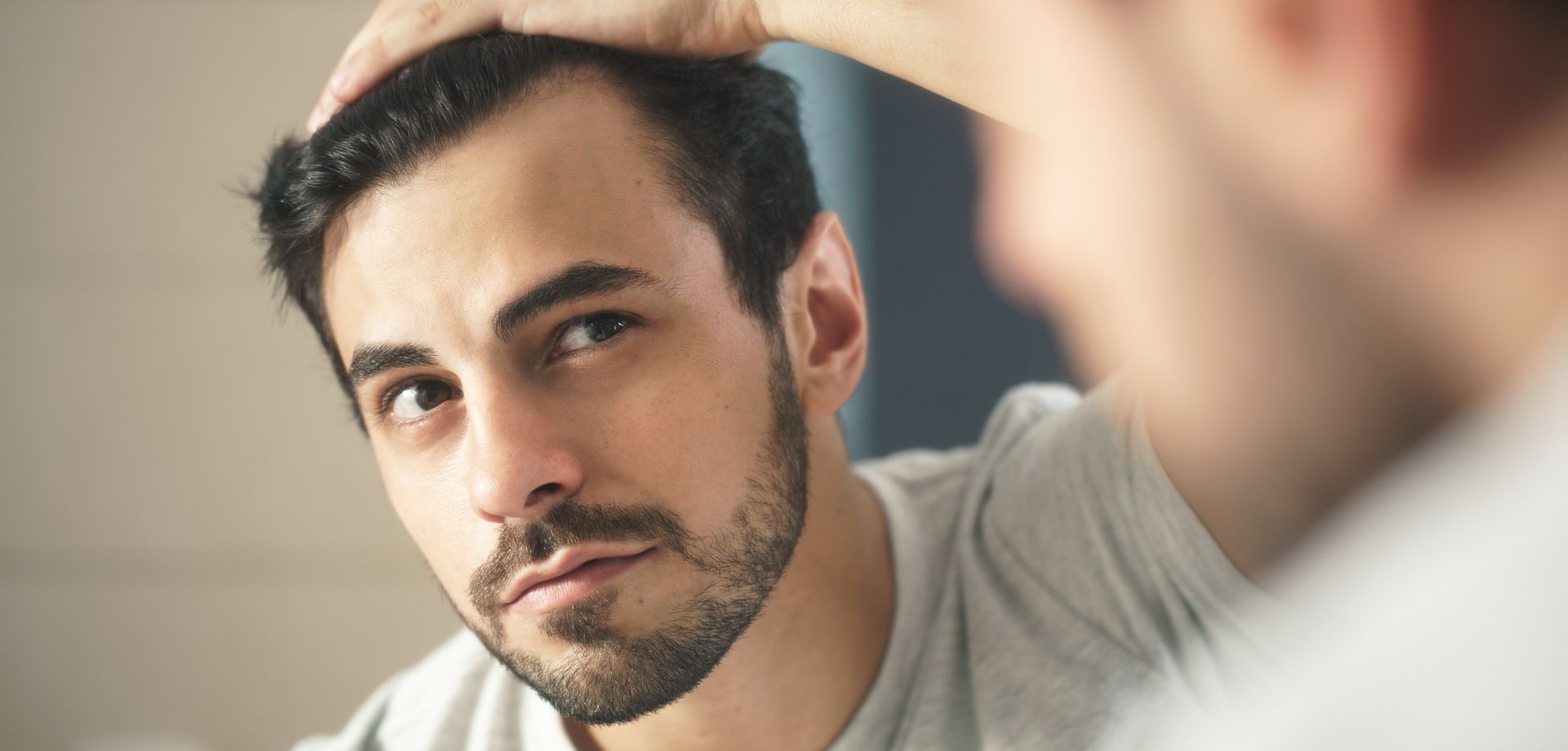 Escala Hamilton-Norwood para medir la alopecia en hombres